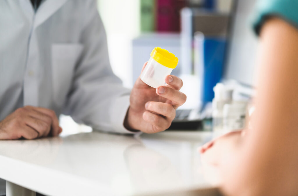 Random Drug Testing at Work: Your Rights & Options